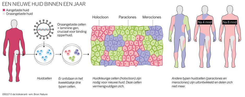 Doorbraak in gentherapie van huidcellen | Debra Belgium vzw
